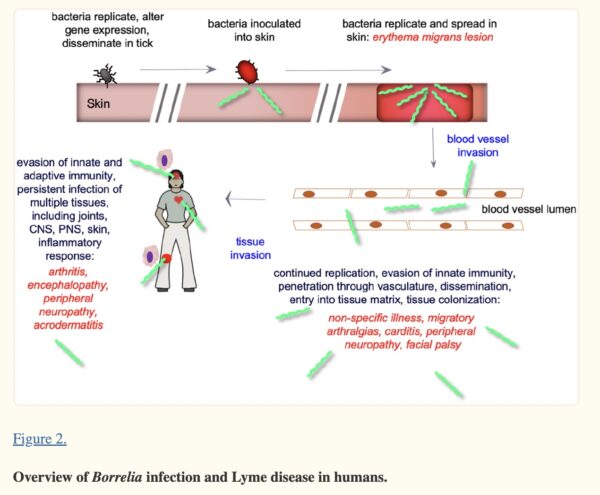Chronic Lyme: Genetic Susceptibility- Genetic Lifehacks