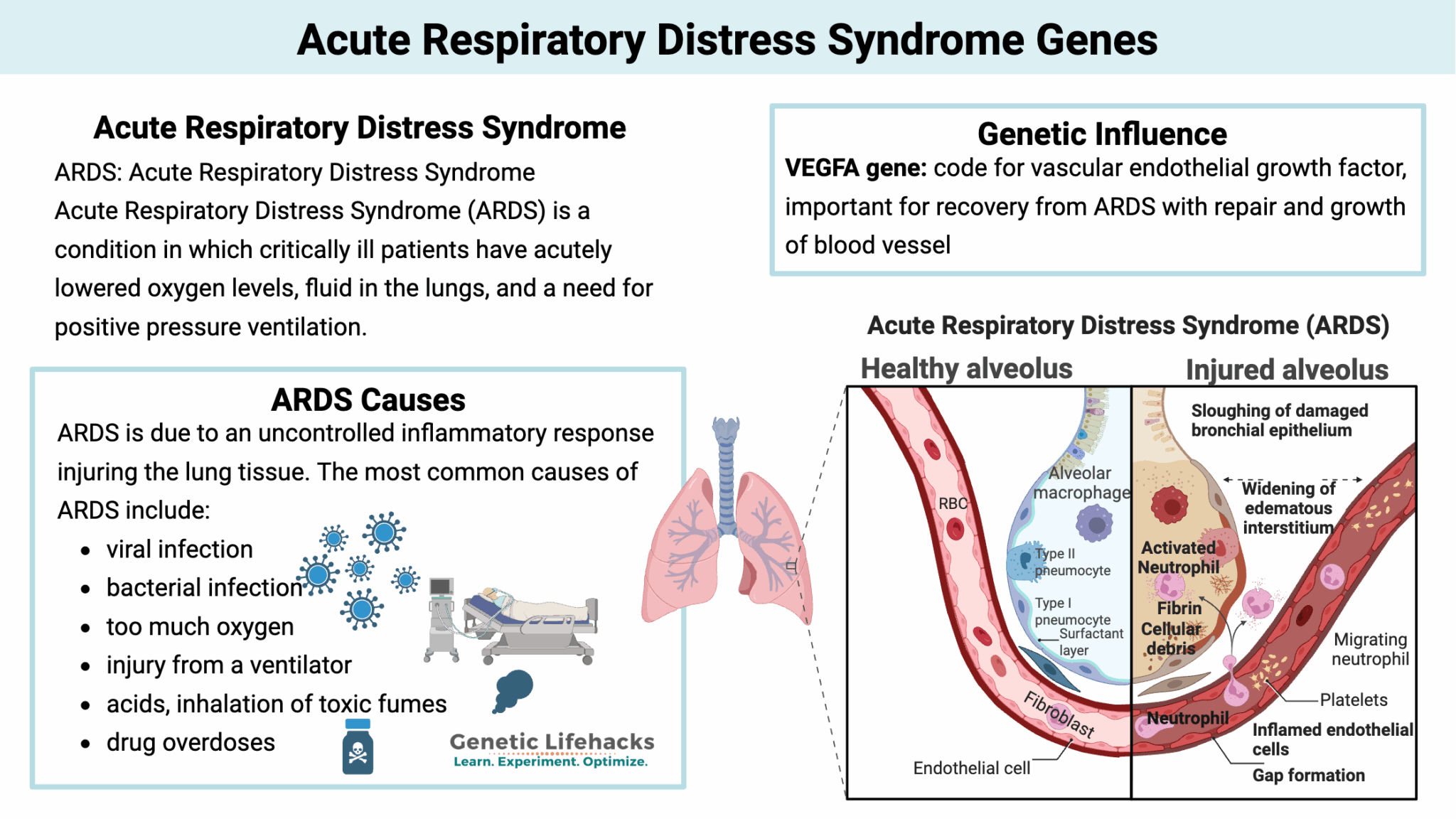 Acute Respiratory Distress Syndrome Genes - Genetic Lifehacks