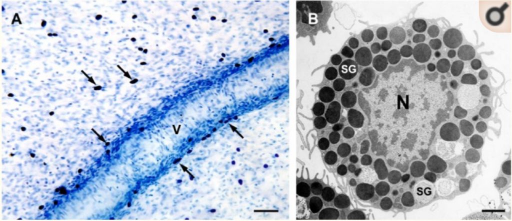 Mast Cells: MCAS, Genetics, and Solutions