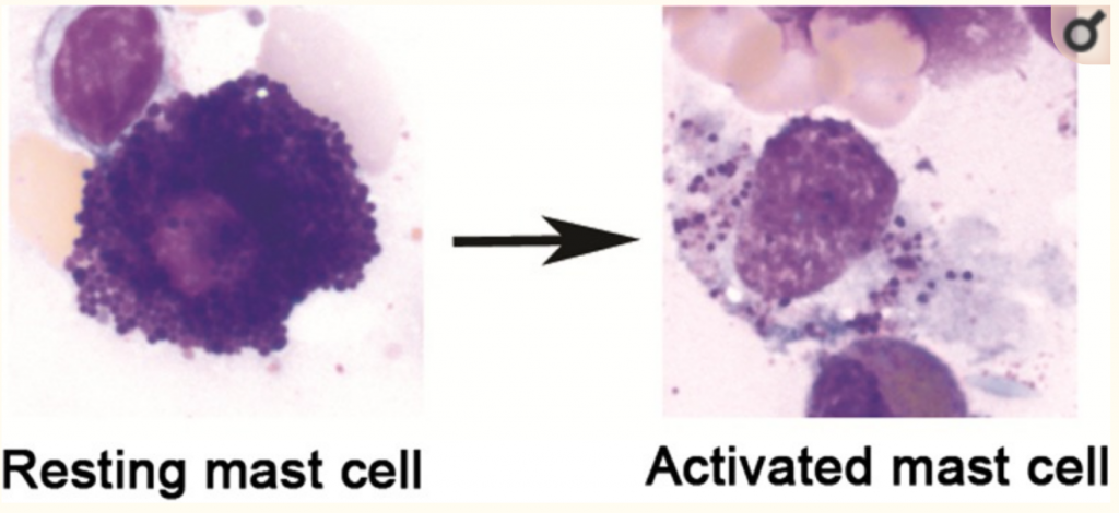 Mast Cells: MCAS, Genetics, and Solutions