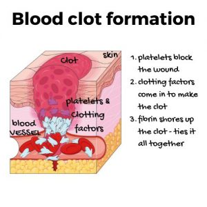 7 Genetic Variants that Increase your Risk of Blood Clots