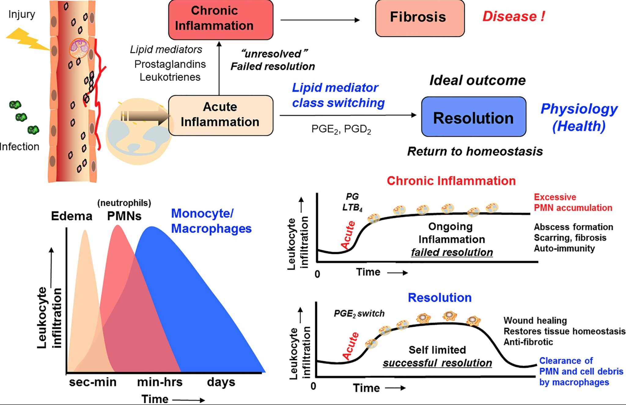 Specialized Pro-resolving Mediators (SPMs): The Resolution of Inflammation