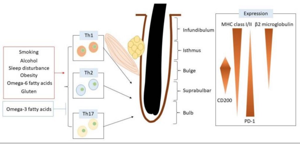 Alopecia Areata: Reasons for Rapid Hair Loss