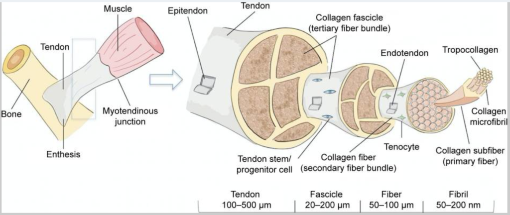 Tendinitis (Tendonitis): Genes, Inflammation, and Targeted Solutions
