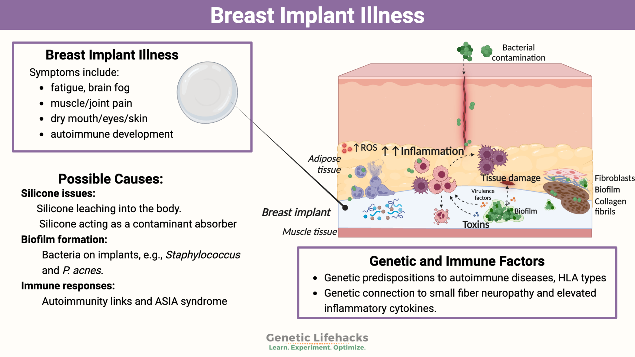 Breast Implant Illness: The Interplay of Genetics and Symptoms