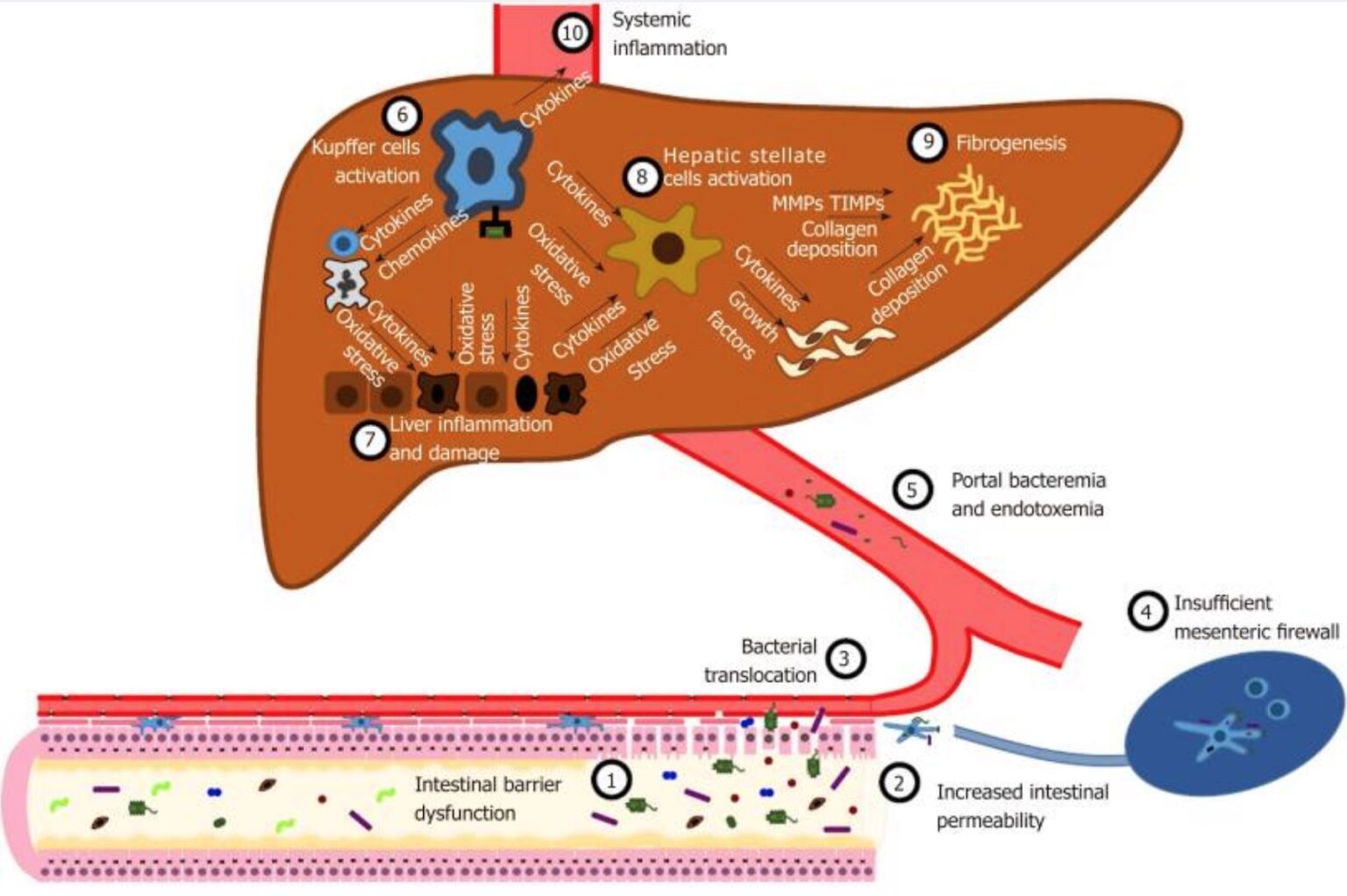 Primary Sclerosing Cholangitis