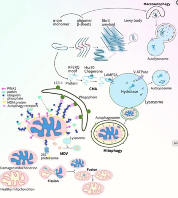 Parkinson's Disease: Genetic Causes and Risk Factors