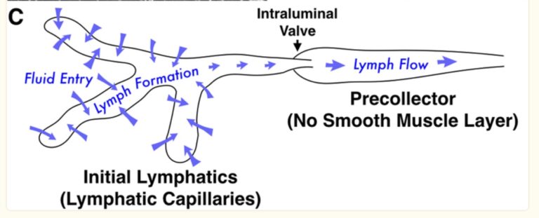 Lymphedema: Causes and Genetic Pathways