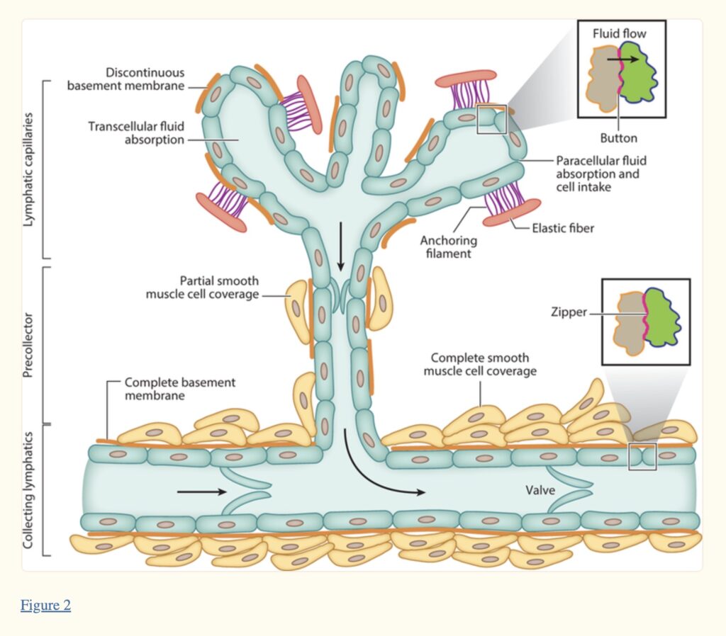 Lymphedema: Causes and Genetic Pathways