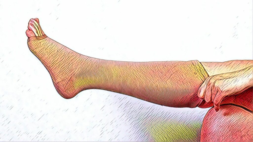 Inflammation and Immune Response