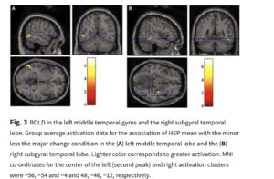 Highly Sensitive People: Genes, Brain Function, and Sensory Sensitivity